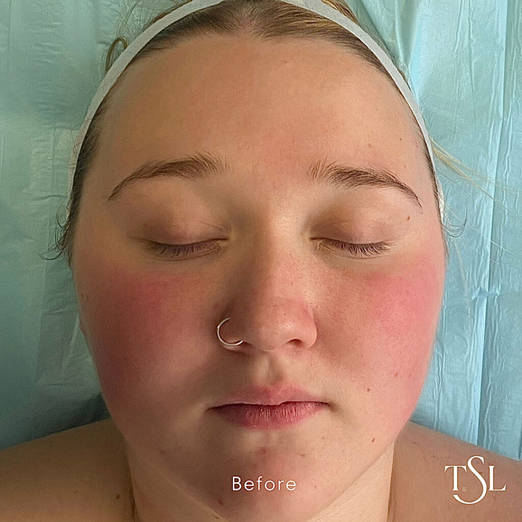 Cosmeceutical Facials | The Skin Lab