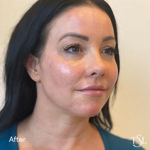 Skin & Laser Clinic Brisbane | The Skin Lab